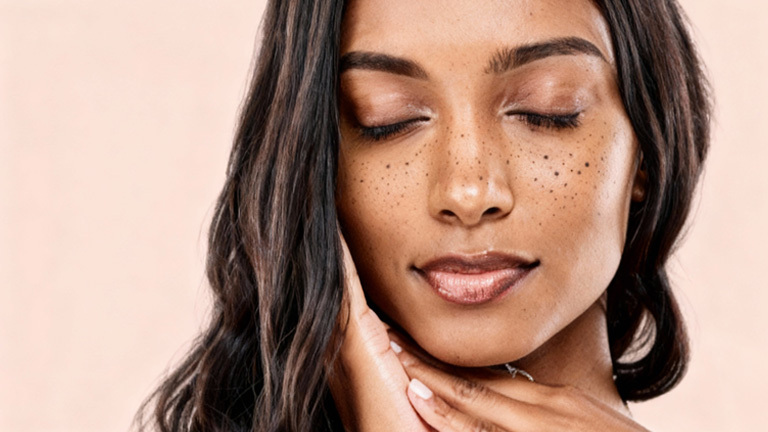 How to Treat and Prevent Black Spots on Face Naturally? - FMS SKIN