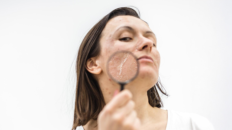 How to Remove Dead Skin Cells Naturally | FMS Skin and Hair Clinic