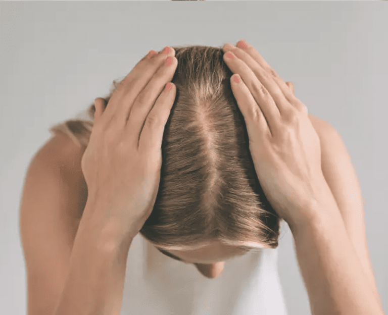 Chronic Telogen Effluvium | Hair Loss Treatment | FMS Skin & Hair Clinics